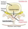 16 Daten und Fakten zum Atlaswirbel: Anatomie & Verschiebung